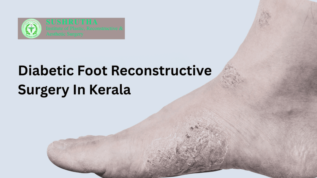Diabetic Foot Reconstructive Surgery In Kerala - thrissurplasticsurgery