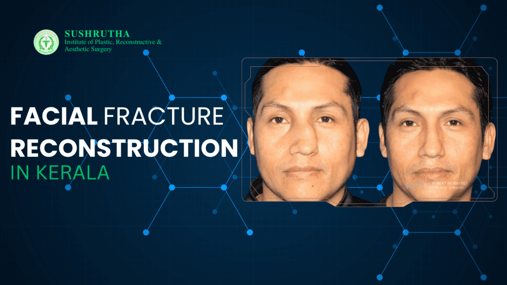 Facial Fracture Reconstruction in Kerala – Advanced Care for Restoring ...